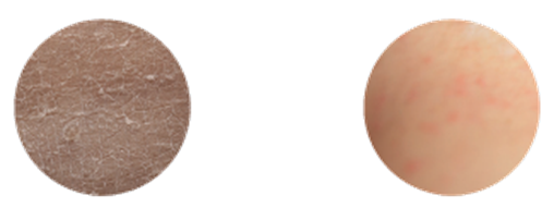 Сечовина в косметиці — EVA.UA